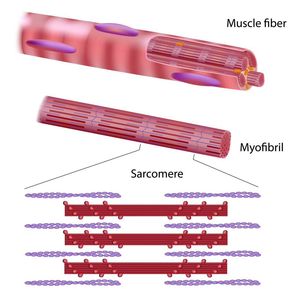 Hypotonus – Scottish Acquired Brain Injury Network