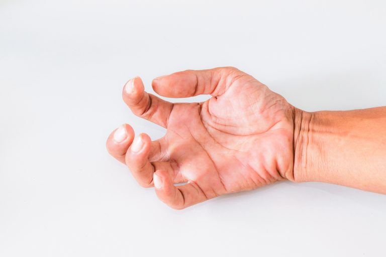 Understanding Spasticity – Scottish Acquired Brain Injury Network